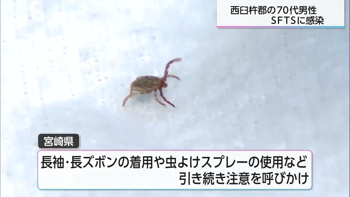 野外活動の際は肌の露出避けて SFTSの感染新たに1人報告 （2025年9月25日掲載）｜UMK NEWS NNN