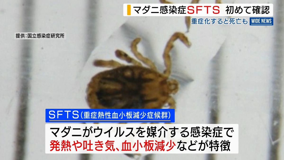 死に至るケースも…マダニ感染症「SFTS」県内で初確認 峡南の80代女性 山梨 （2025年10月20日掲載）｜YBS NEWS NNN